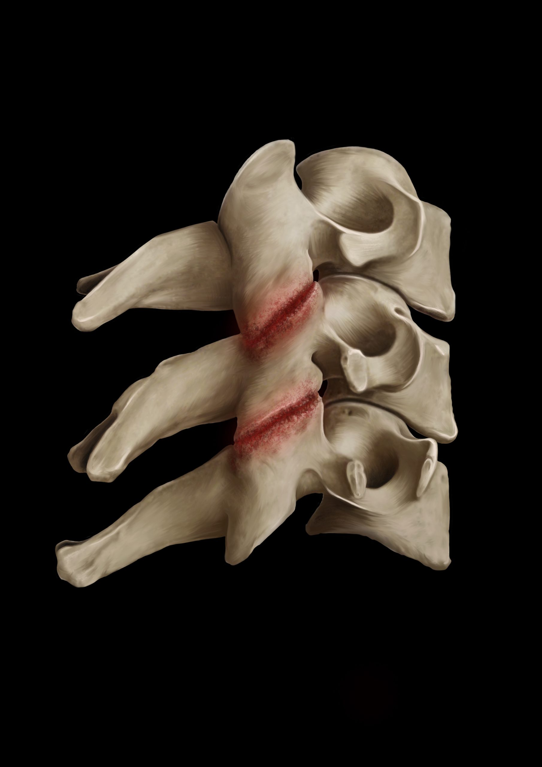Neurokirurgija – Rotim